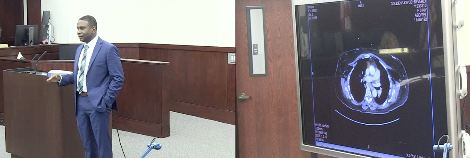 Jury Clears ER Doc In $9M Endoscopy Wrongful Death Trial: Watch Gavel-to-Gavel